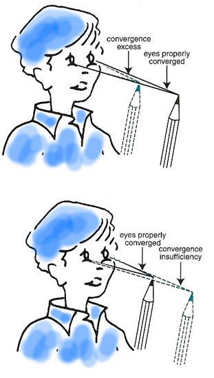 Common Eye Conditions in Children | Aphrodite Livanes Optometrist ...